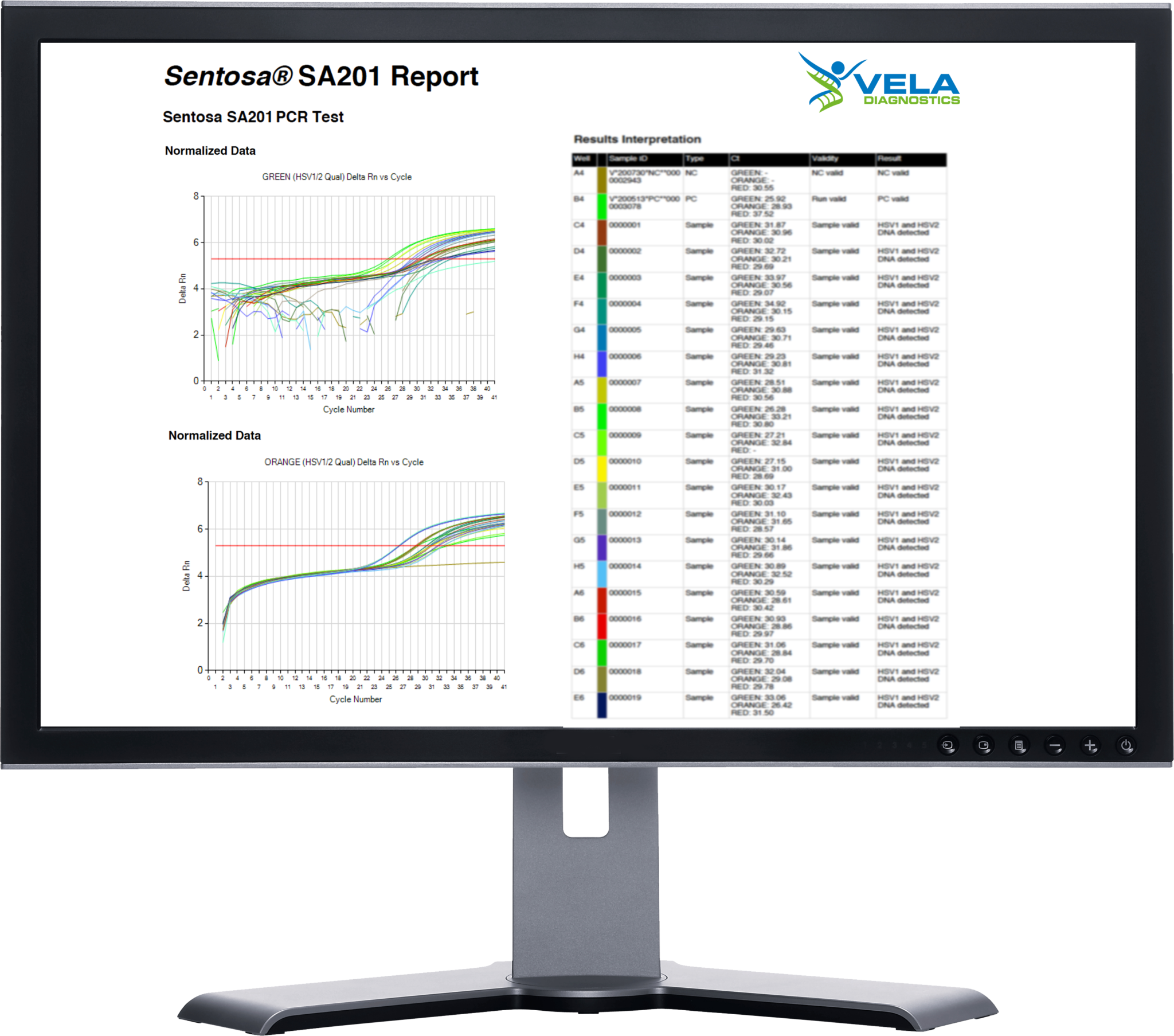 Sentosa SA201 Reporter – Freshstart Medical Labs